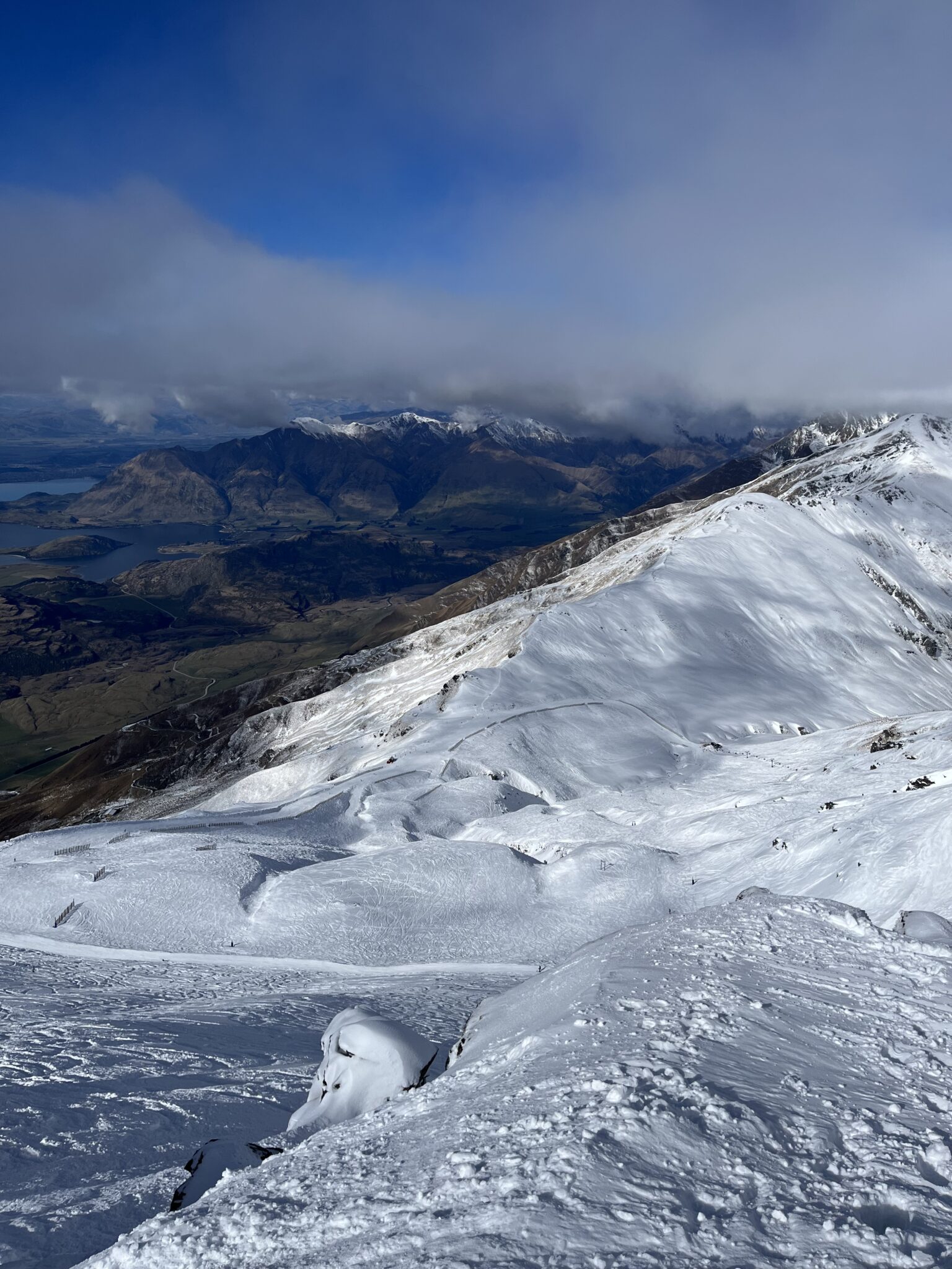 世界との差 - tenrakatsuno
